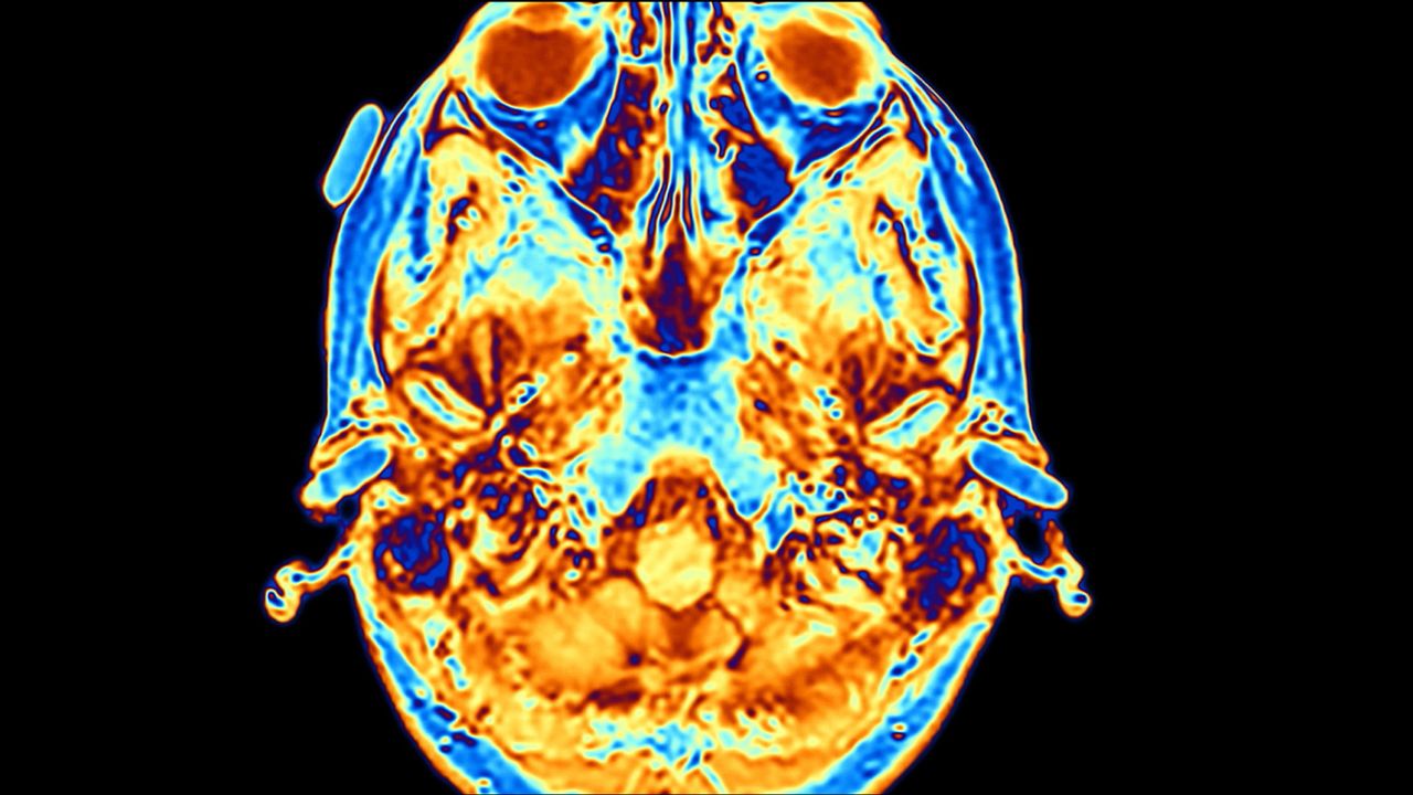 Turning Point (2020): Where to Watch and Stream Online | Reelgood