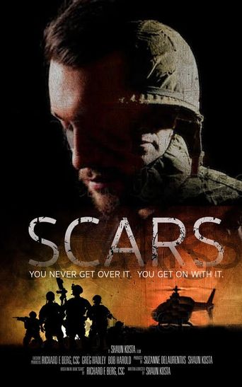 Scars: Where to Watch and Stream Online | Reelgood