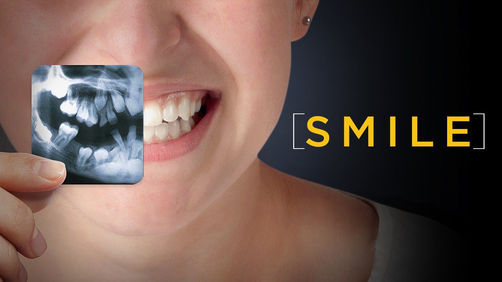 Smile - Where to Watch Every Episode Streaming Online Available in the ...
