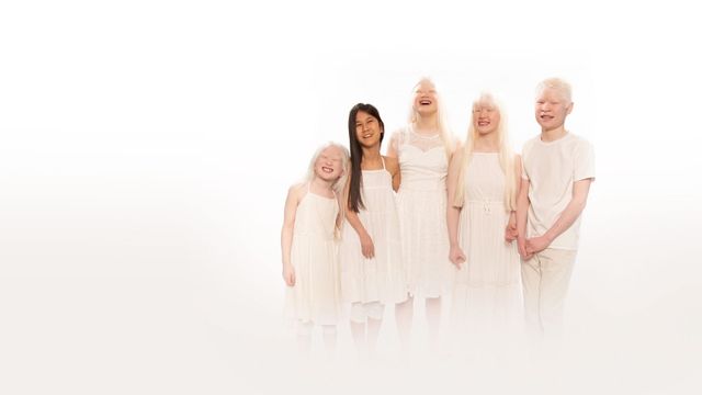 Born with Albinism Season 1: Where To Watch Every Episode | Reelgood
